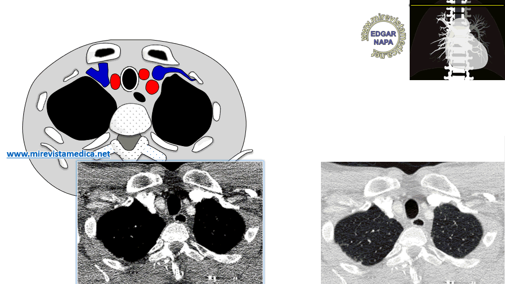 Descripción de diversos temas de anatomía humana, imagenología y ...