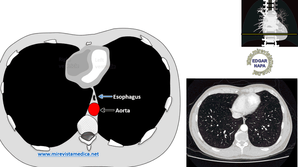Descripción de diversos temas de anatomía humana, imagenología y ...